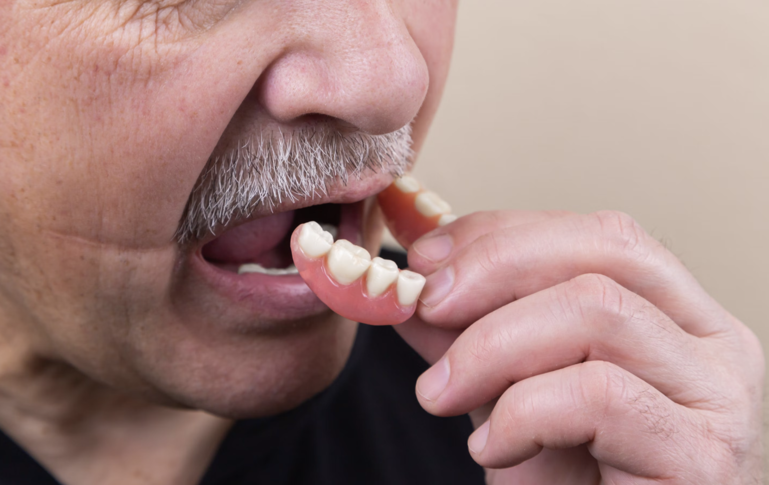 Microplastics from brushing your teeth and wearing plastic aligners ...